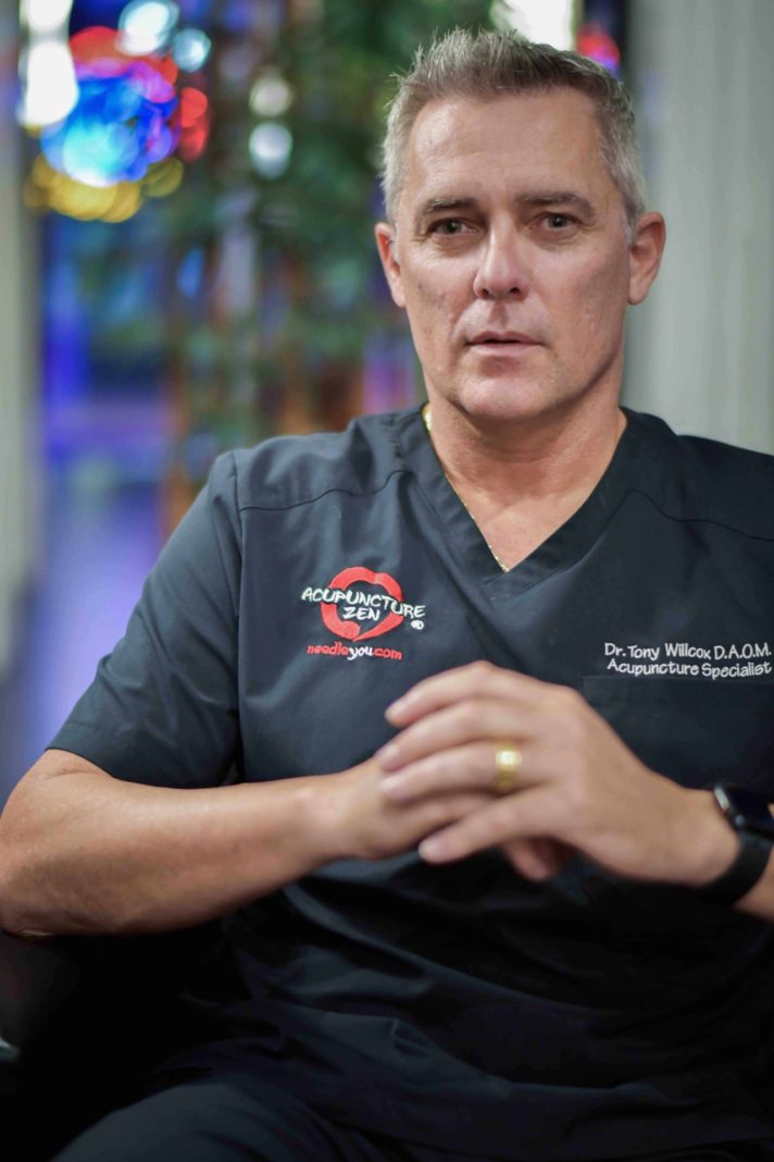 What is Cupping? Dr. Tony Willcox PhD. Acupuncture